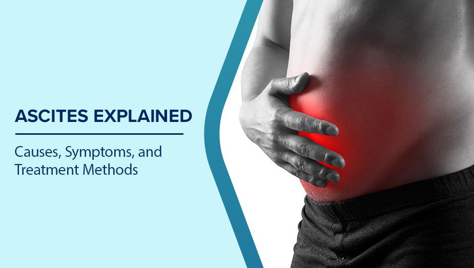 What is Ascites: Symptoms, Causes and Treatment | Max Hospital