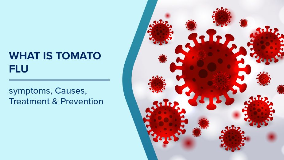 Tomato Flu Virus: Symptoms, Causes & Treatment | Max Hospital