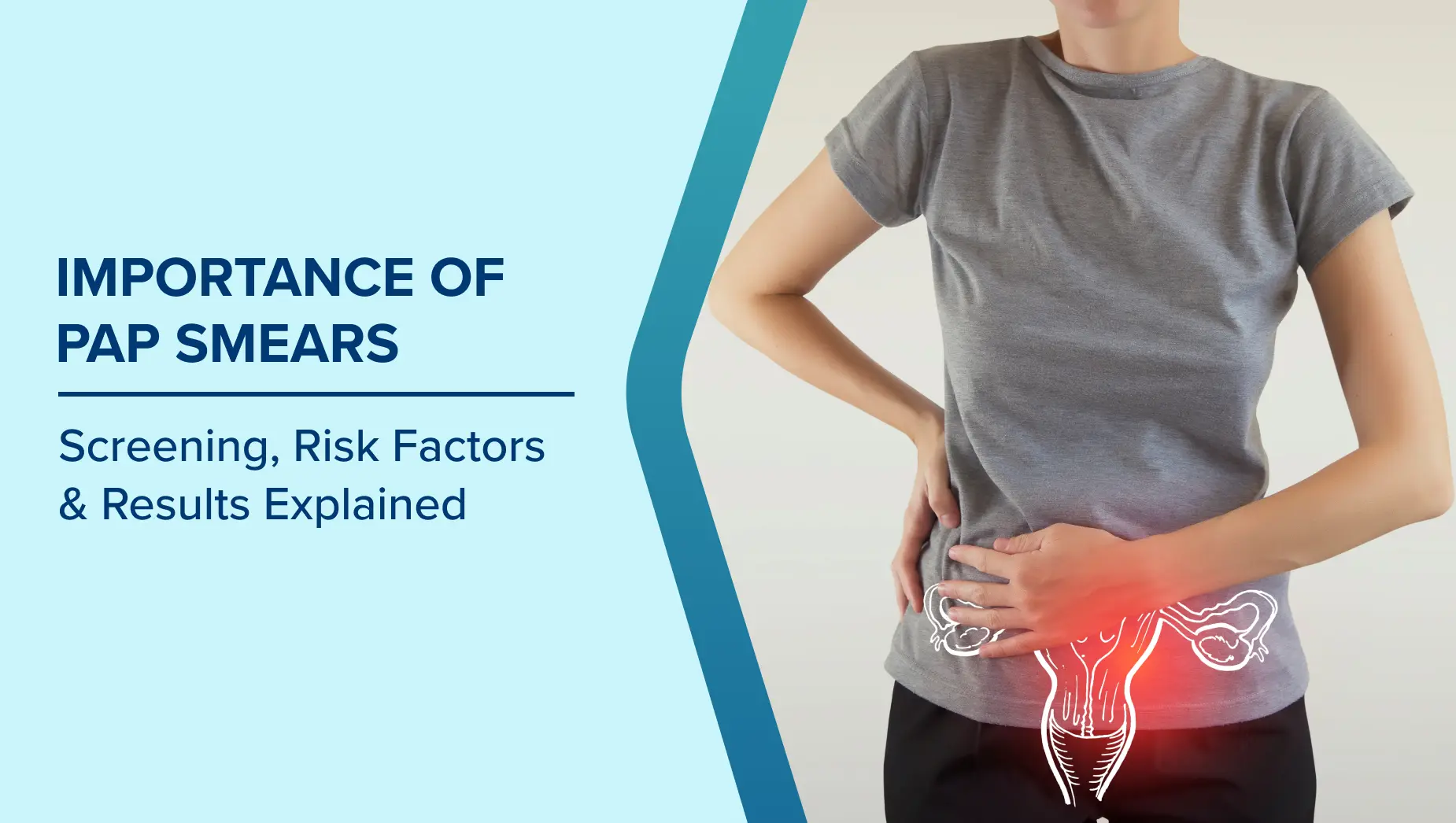 Importance of Pap Smears: Screening, Risk Factors & Results Explained ...