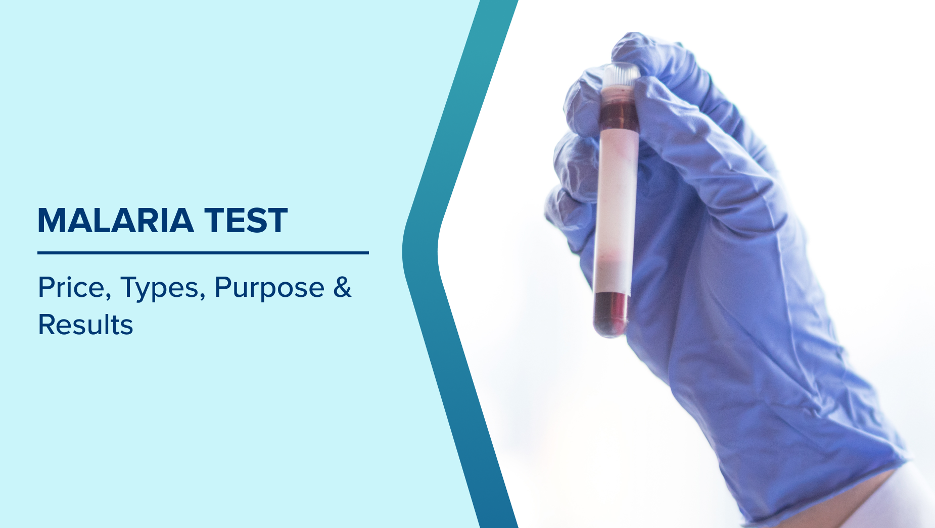 Malaria Test: Price, Types, Purpose & Results | Max Hospital