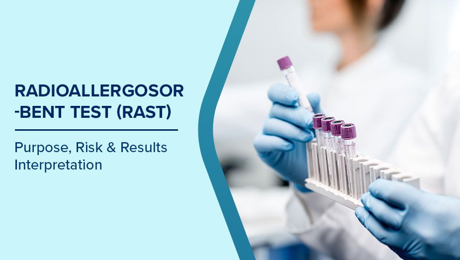 Radioallergosorbent Test (RAST): Purpose, Risk & Results Interpretation ...