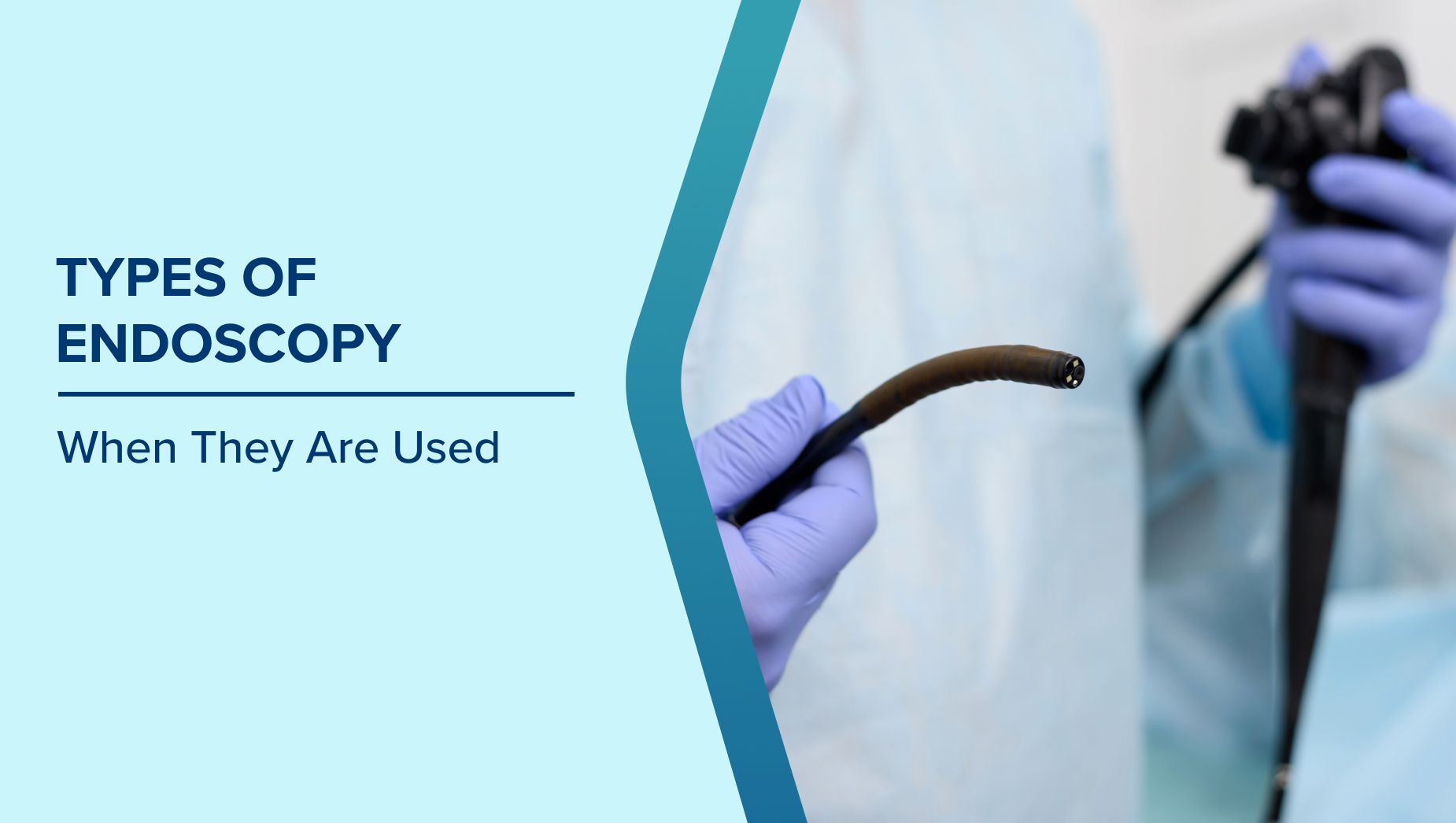 What is Endoscopy: Types, Benefits, and When It’s Needed | Max Hospital