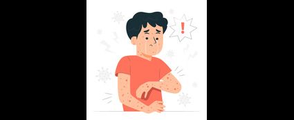 Chicken Pox Symptoms: Early Signs, Rash Development & Causes Explained