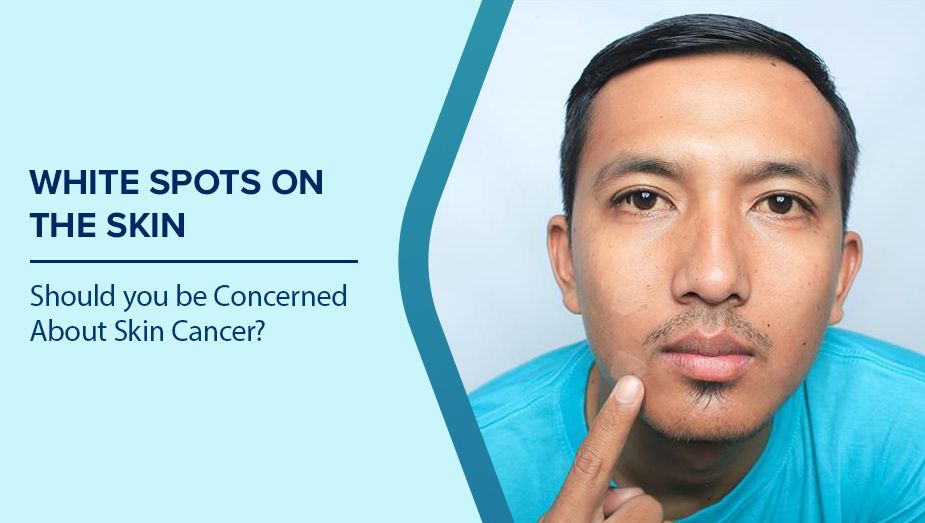 White Spots on Skin: Causes, Cancer Risk & Treatments | Max Hospital